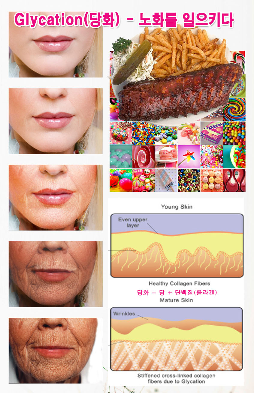 당독소(Glycation End Product) - 미라클 통합기능의학 센터